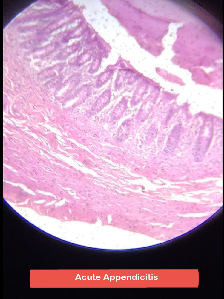 Pathology Slides 1 | PDF