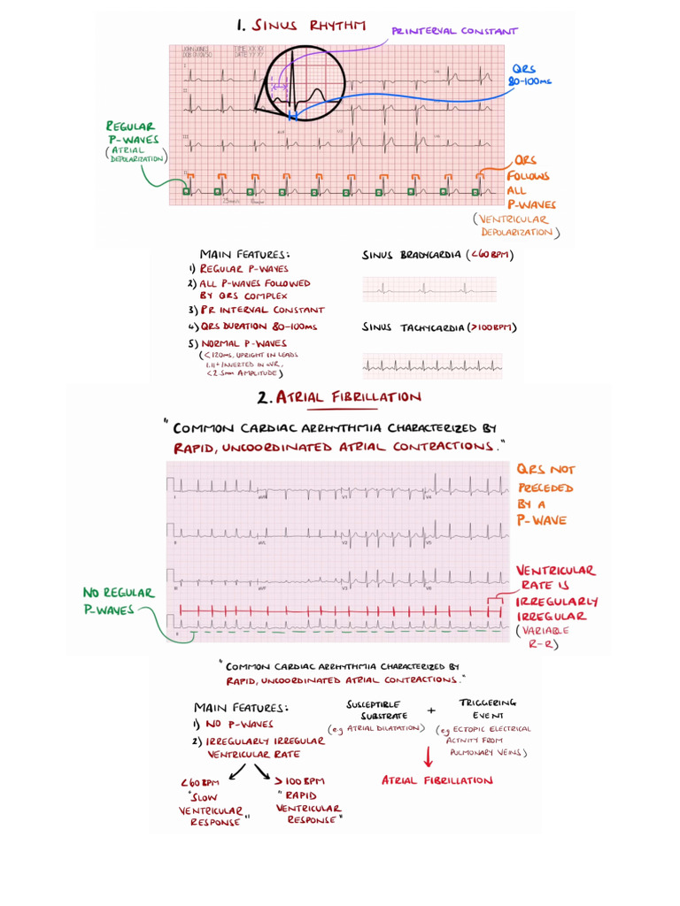 ECG | PDF