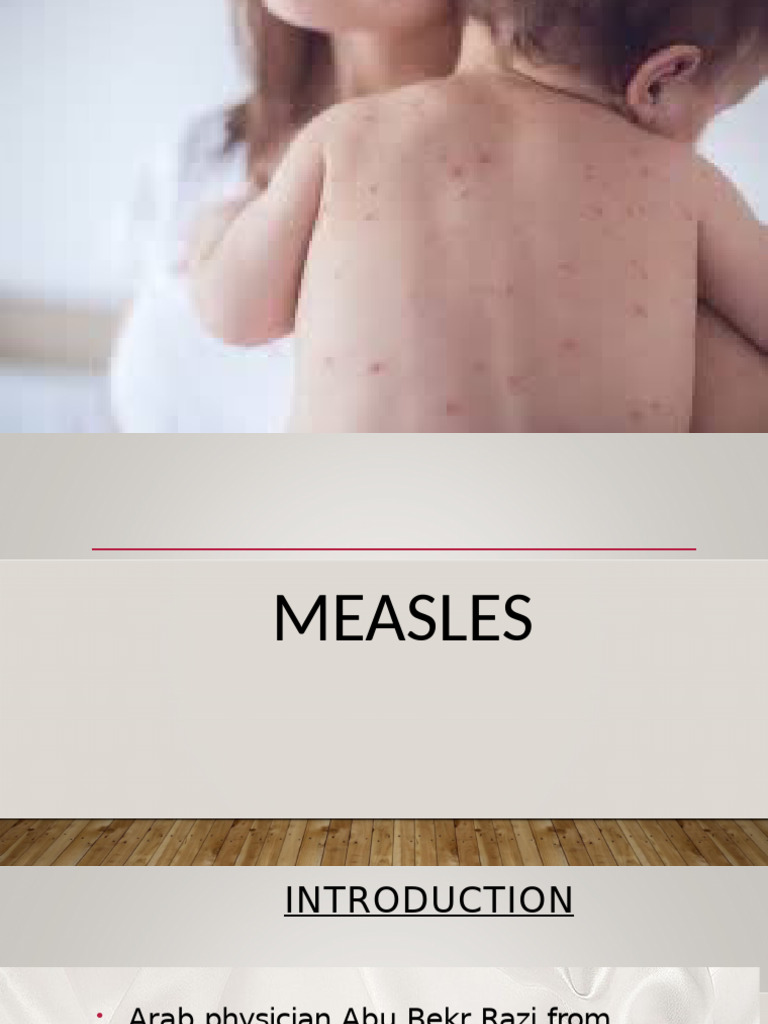 Measles | PDF | Measles | Infection
