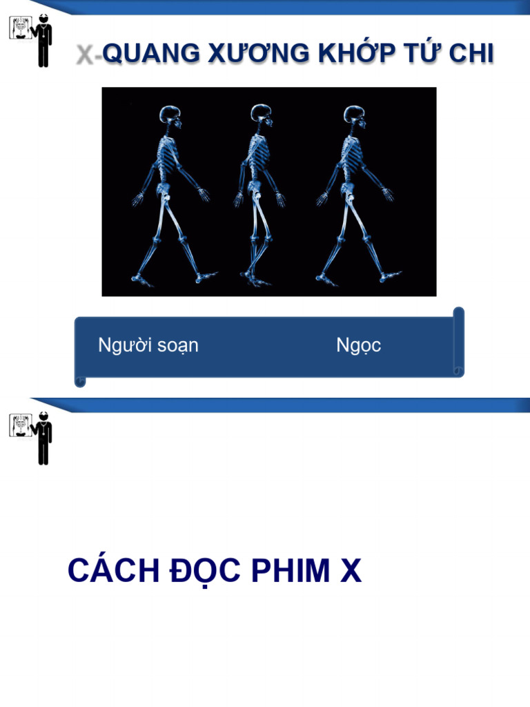 Xquang Xương KH P T Chi - 2022!06!10 - SV | PDF