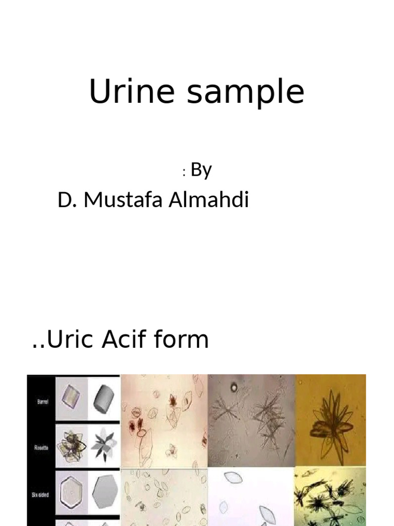 Urine Sample | PDF