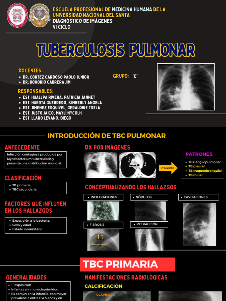 Grupo e - Diagnostico Por Imagen - Exposición N°5 | PDF | Pulmón ...