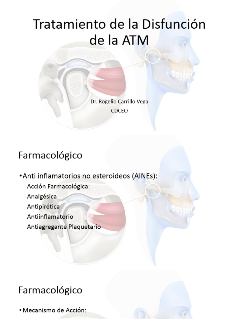 Tratamiento de La Disfunción de La ATM | PDF | Droga anti-inflamatoria ...