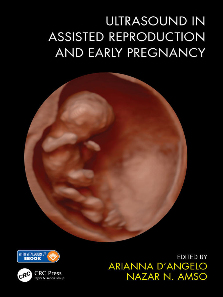 Ultrasound in Assisted Reproduction & Early Pregnancy, 2021 | PDF ...
