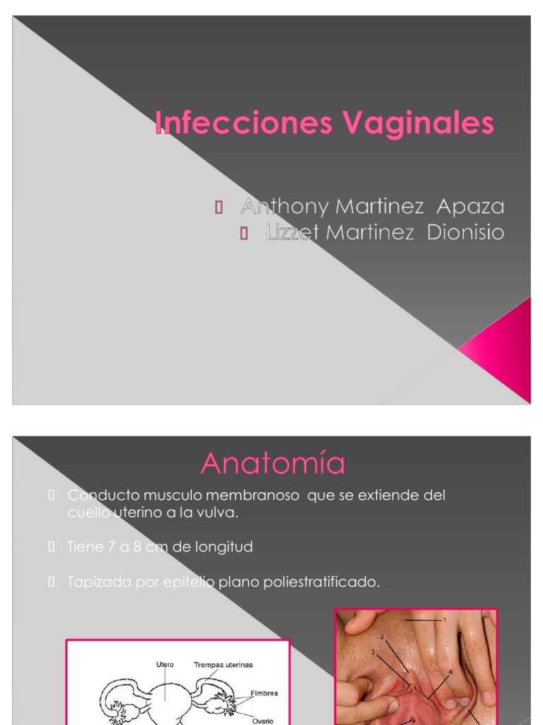 Infecciones Vaginales | Vagina | Reproducción humana