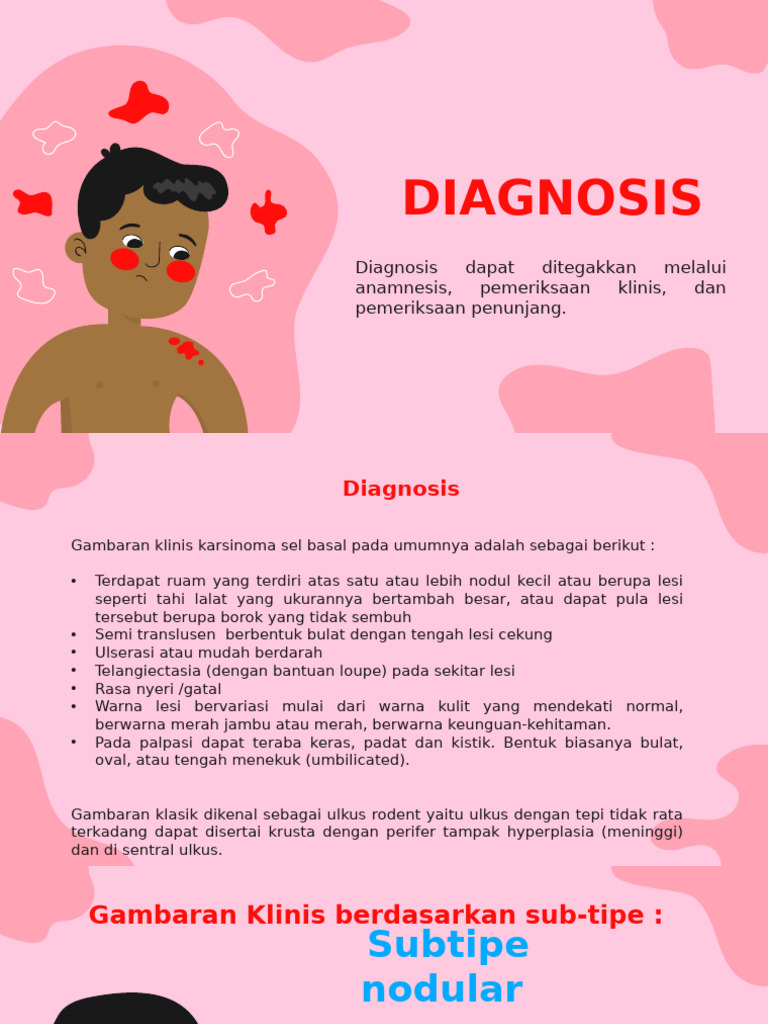 Diagnosis Basalioma | PDF