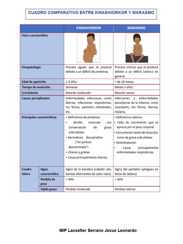 Kwashiorkor-Vs-Marasmo Leo | PDF | Medicina CLINICA | Especialidades ...