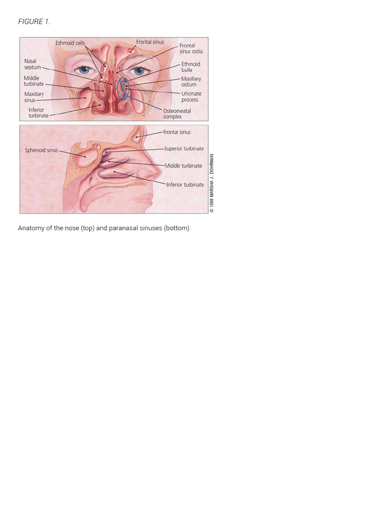 Image of Sinus | PDF