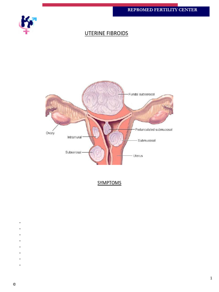 uterine-fibroids | PDF | Uterus | Clinical Medicine