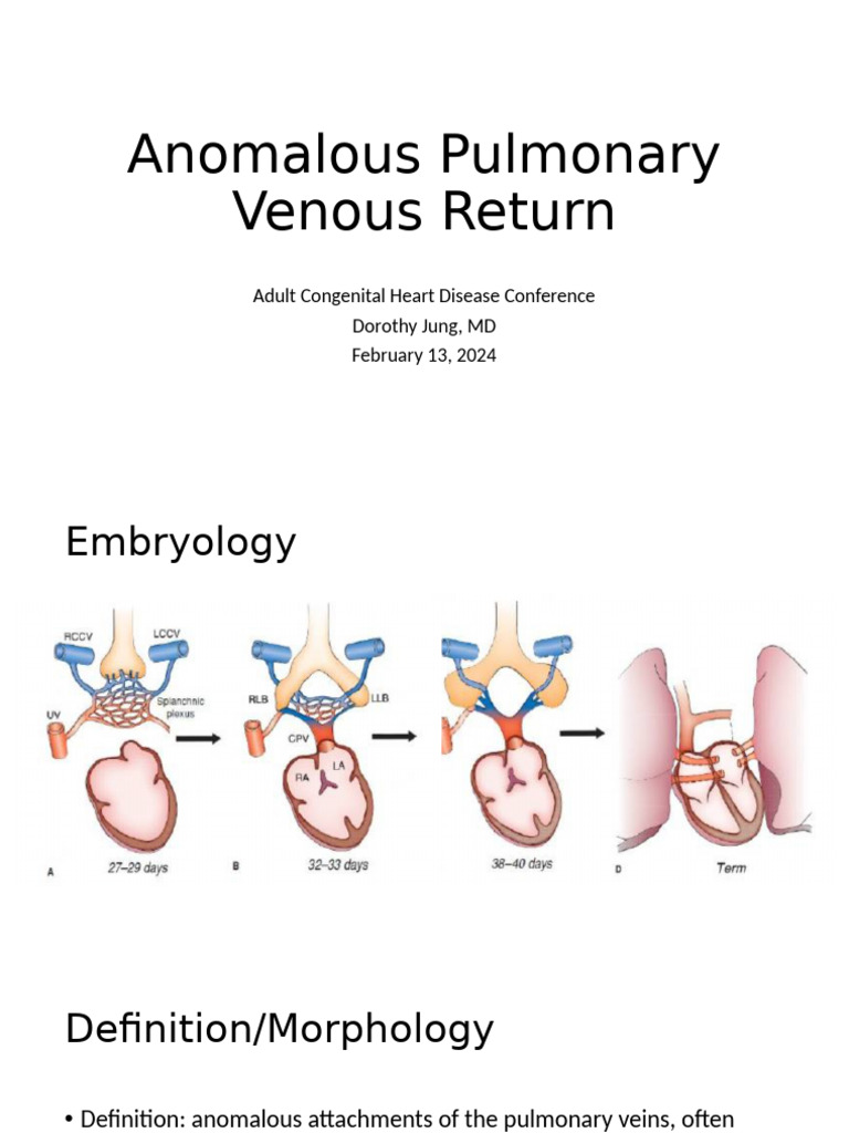 Anomalous Pulmonary Venous Return 021324 | PDF | Vein | Heart