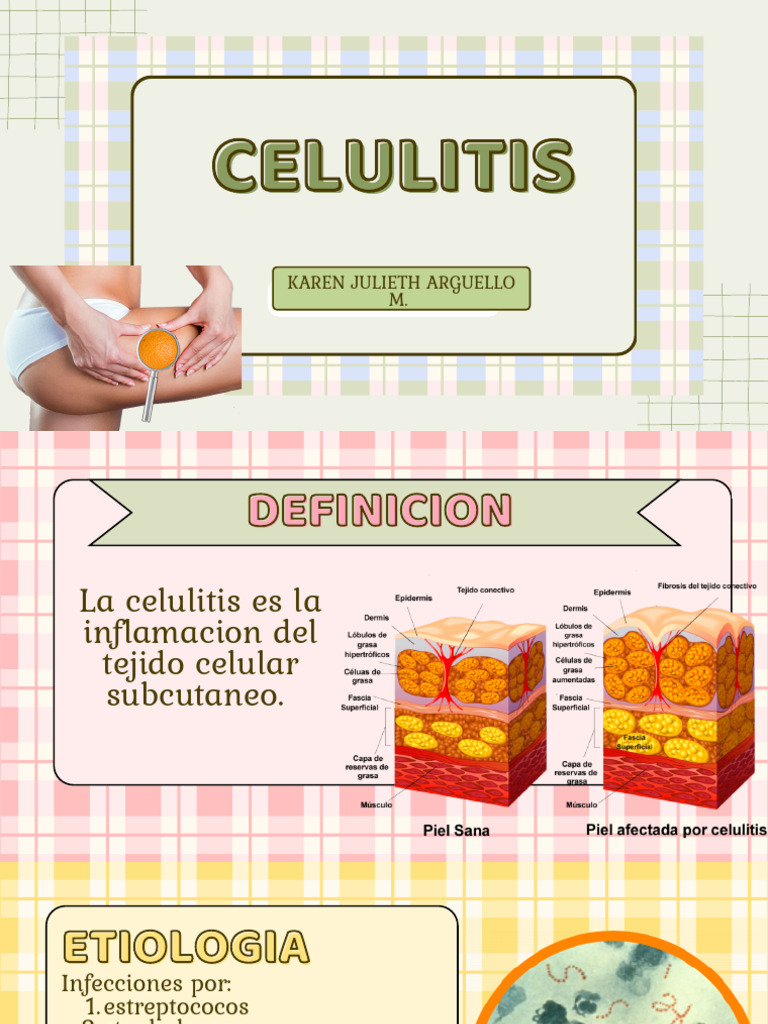 CELULITIS | PDF