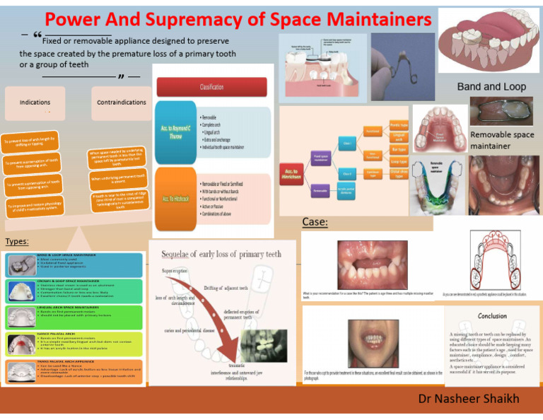 Space Maintainer E-Poster | PDF