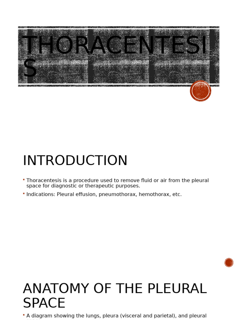 Thoracentesis | PDF