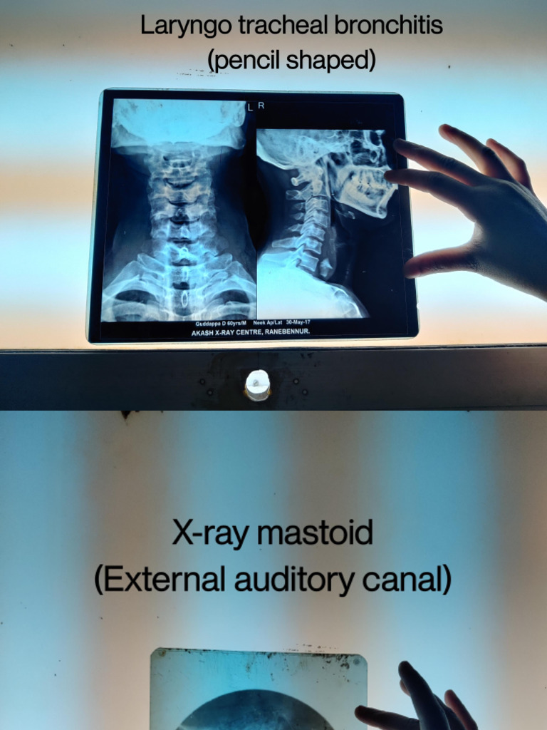 ENT Clinical Part | PDF