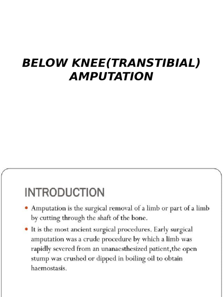 Bk Amputation | PDF