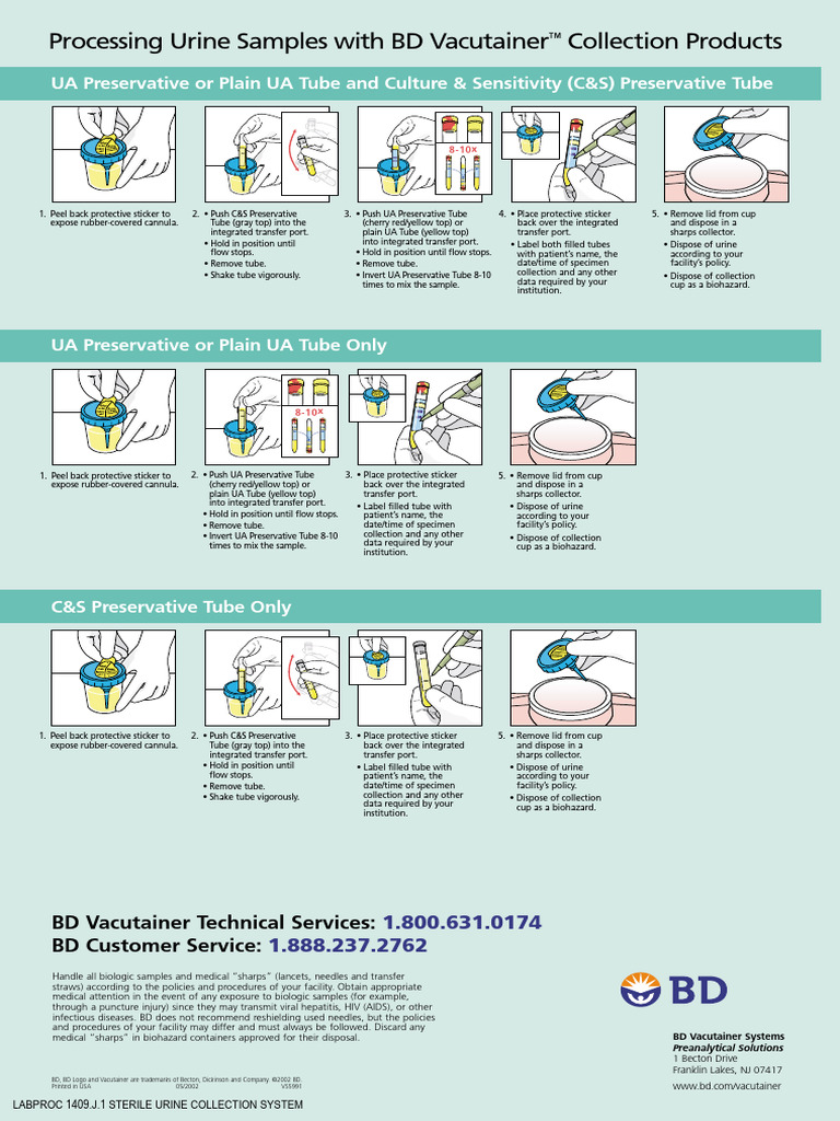 Urine Sample Processing BD Cup-1 | PDF | Medical Specialties | Clinical ...