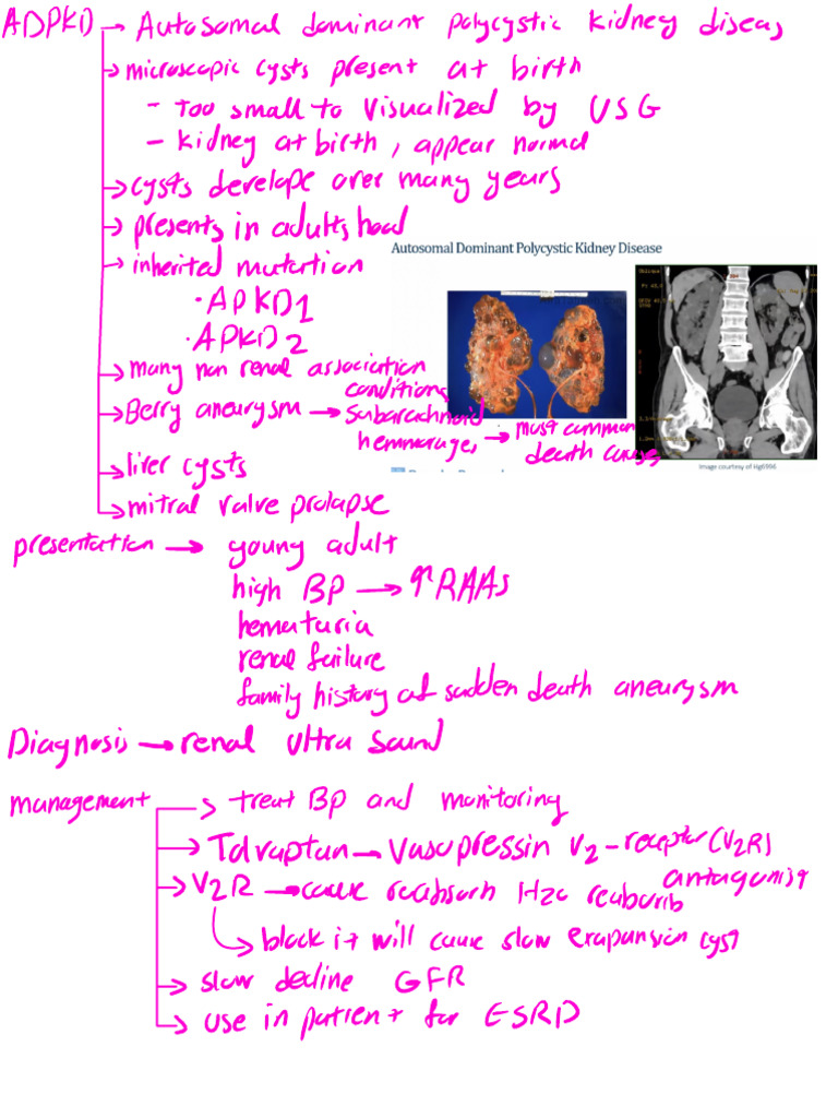 Custic Kidney Disease | PDF | Kidney | Urinary Tract Infection
