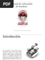 Tipping y Torque en Ortodoncia | PDF | Especialidades Medicas | Ramas ...