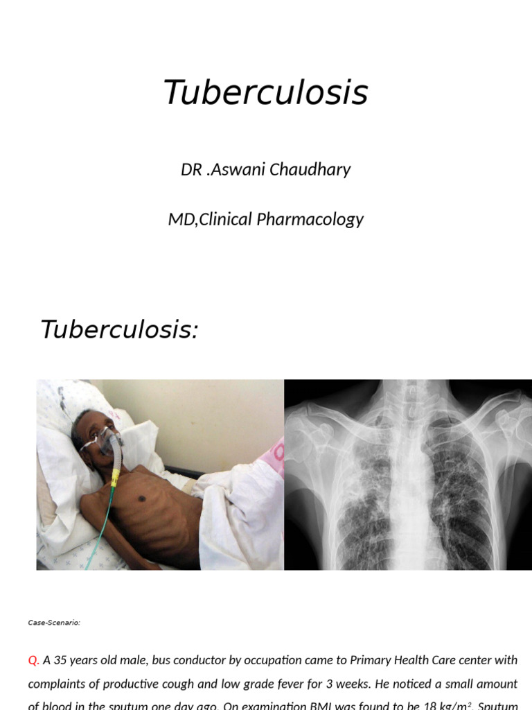 TB-1 | PDF | Tuberculosis | Medical Specialties
