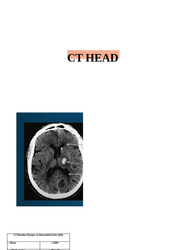 CT Anatomy: Head, Thorax, Abdomen | PDF | Vertebra | Stomach