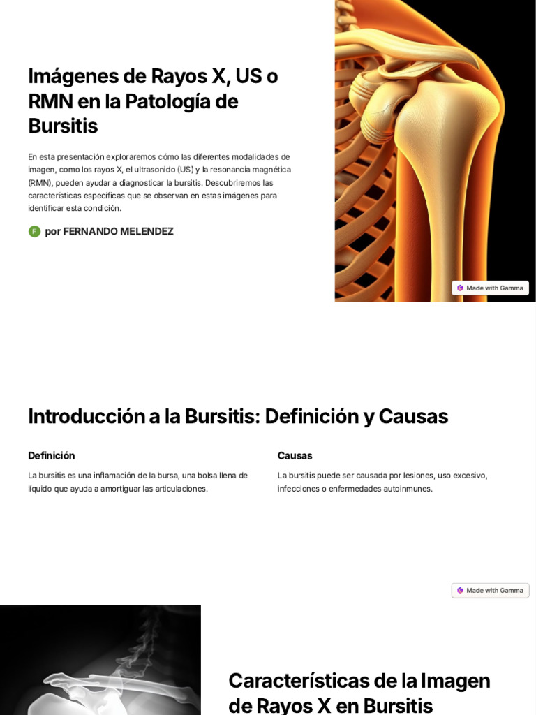 Diagnóstico por Imágenes de Bursitis | PDF | Ultrasonido | Resonancia magnética nuclear