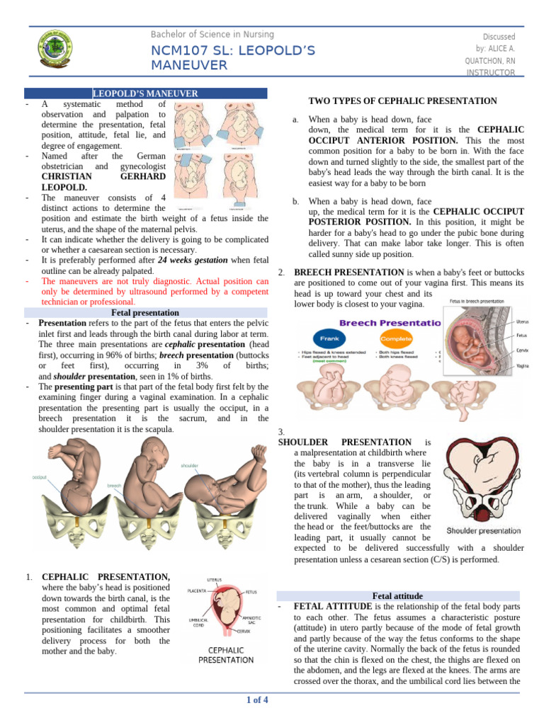 Handouts LEOPOLDS MANEUVER | PDF | Childbirth | Maternal Health