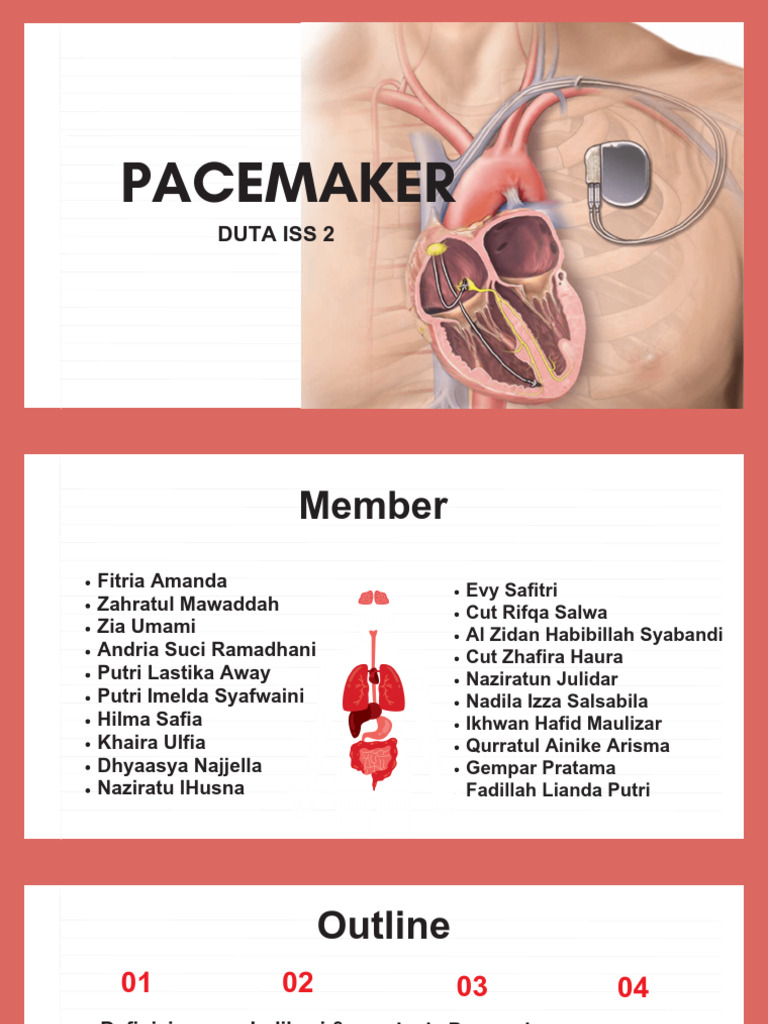 PPT PACEMAKER DT 3 | PDF
