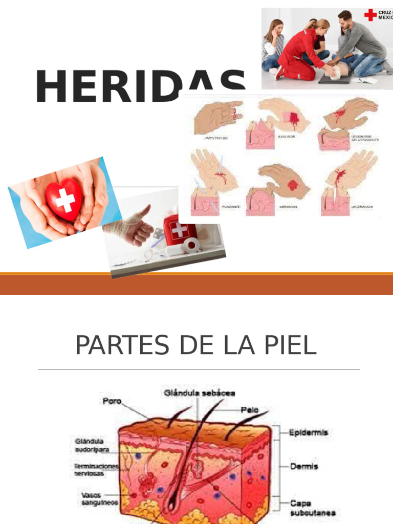 Primeros Auxilios Heridas | PDF