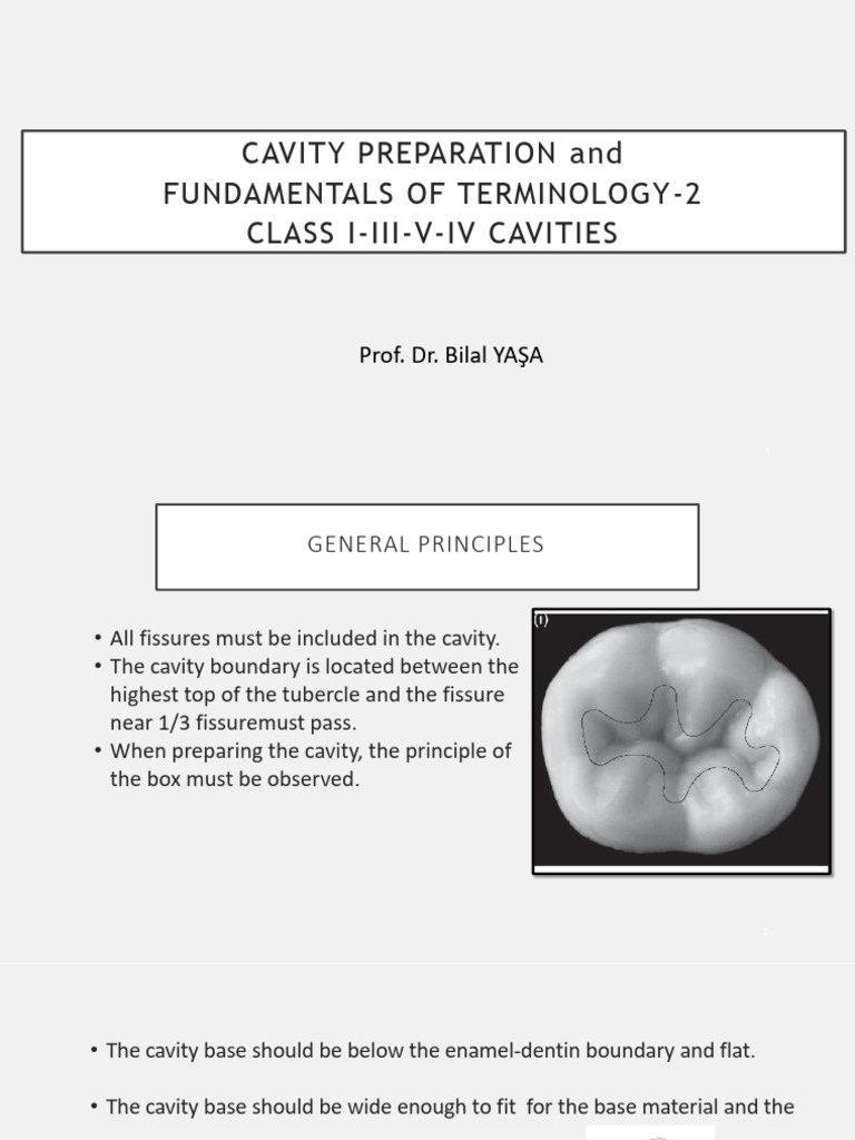 Class I-III Cavity Preparation Guide | PDF | Tooth Enamel | Human Tooth