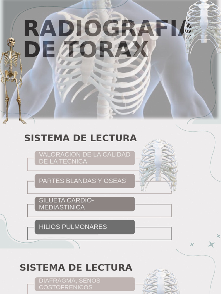 Radiografía de Tórax: Análisis Patológico | PDF | Pulmón | Sistema ...