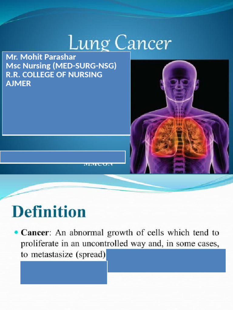 Lungs Cancer | PDF