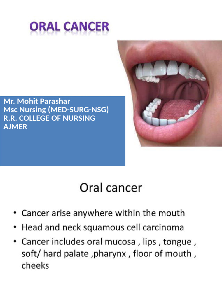 Oral Cancer | PDF