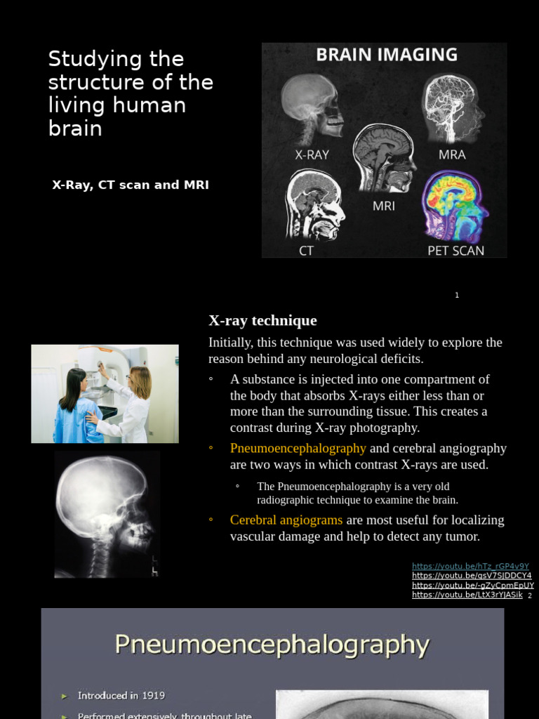 Research Method in Biopsychology - Scanning Methods | PDF ...