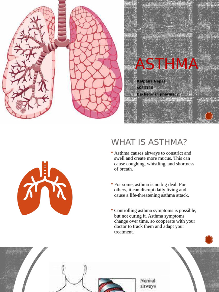 Asthma | PDF | Asthma | Allergen