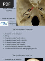 Anatomie et Fractures du Rocher | PDF | Tête et cou chez l'humain ...