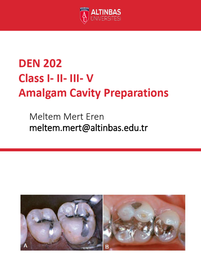 5- Amalgam Cavity Preparations | PDF | Tooth Enamel | Dental Anatomy