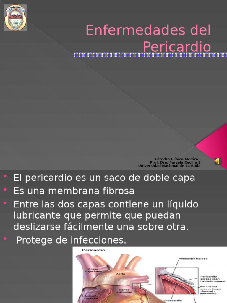 Pericarditis Aguda: Síntomas y Diagnóstico | PDF | Electrocardiografia ...