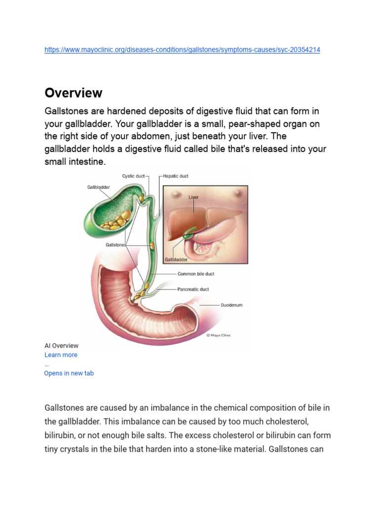 About Gallstones | PDF | Gallbladder | Bile