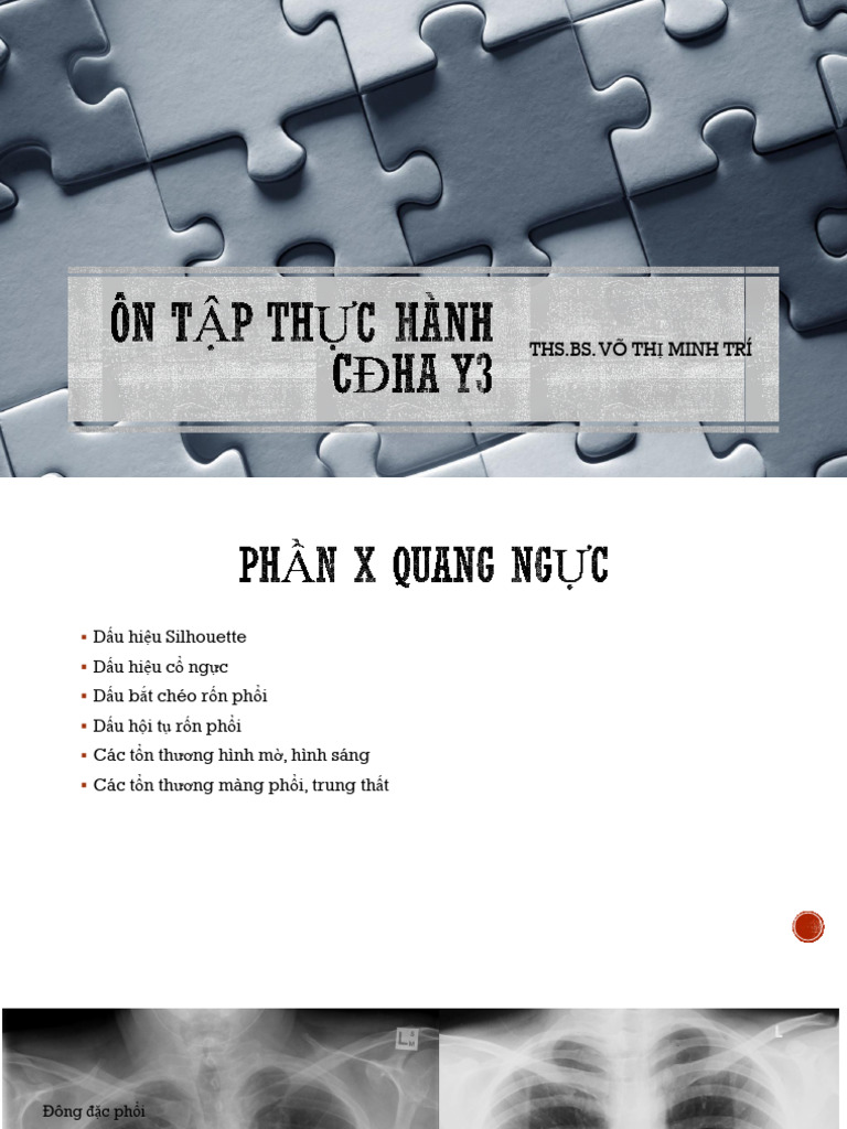 Ôn Tập Thực Hành CĐHA Y3 | PDF