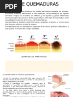 Quemaduras Faciales y Signos de Flogosis | PDF | Quemar | Inflamación