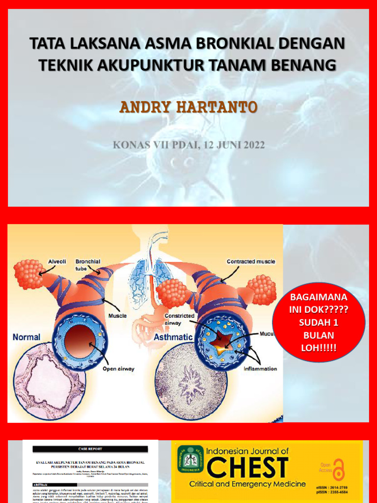 Tata Laksana Asma Bronkial Dengan Teknik Akupunktur Tanam Benang | PDF