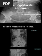 Radiografía de Abdomen y Coprostasis | PDF | Sistema urinario ...