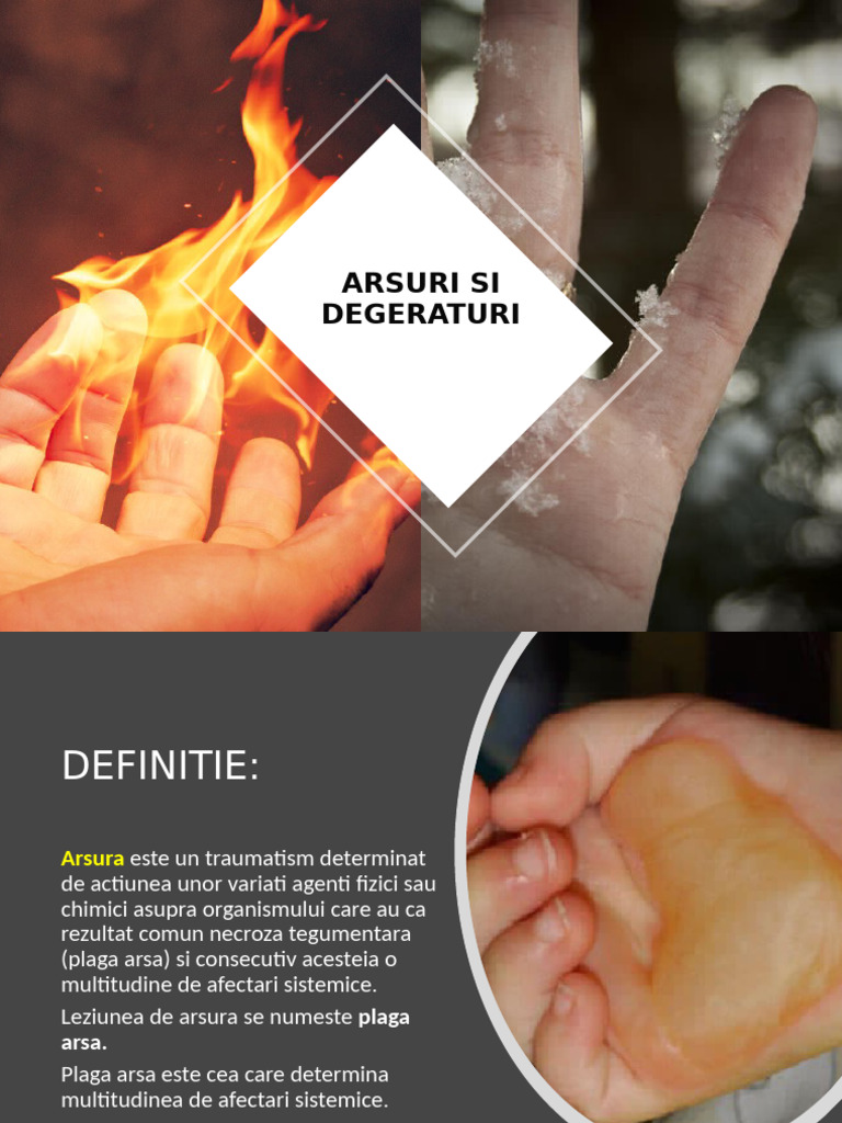 Arsuri Si Degeraturi | PDF