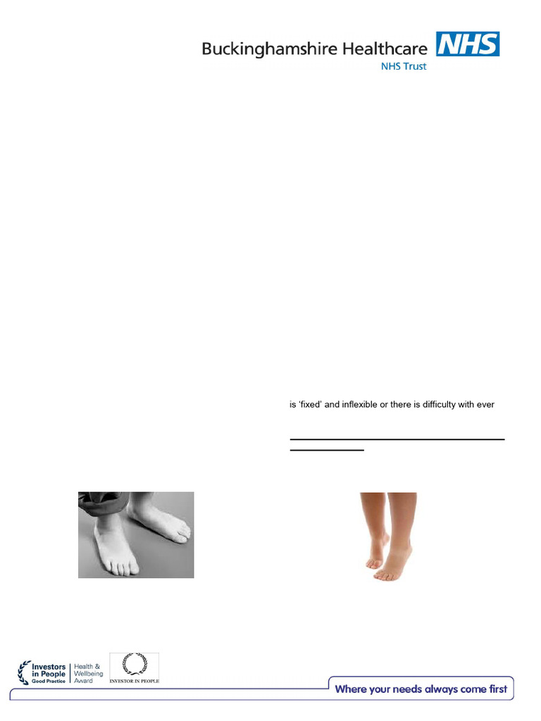 Flexible Flat Feet | PDF | Foot | Musculoskeletal System