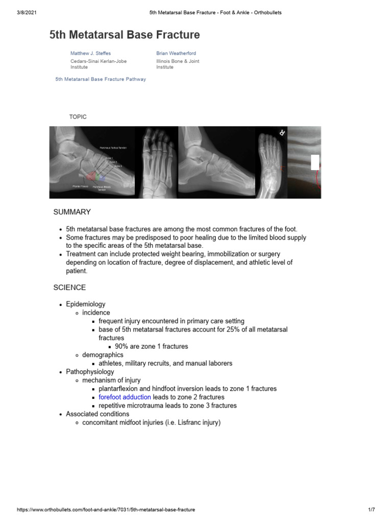 5th Metatarsal Base Fracture - Foot & Ankle - Orthobullets | PDF | Foot ...