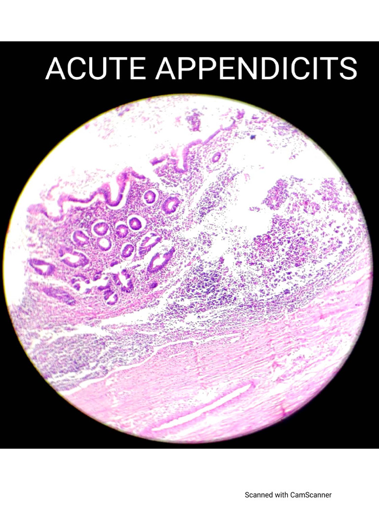 Pathology Slides 240424 195841 | PDF