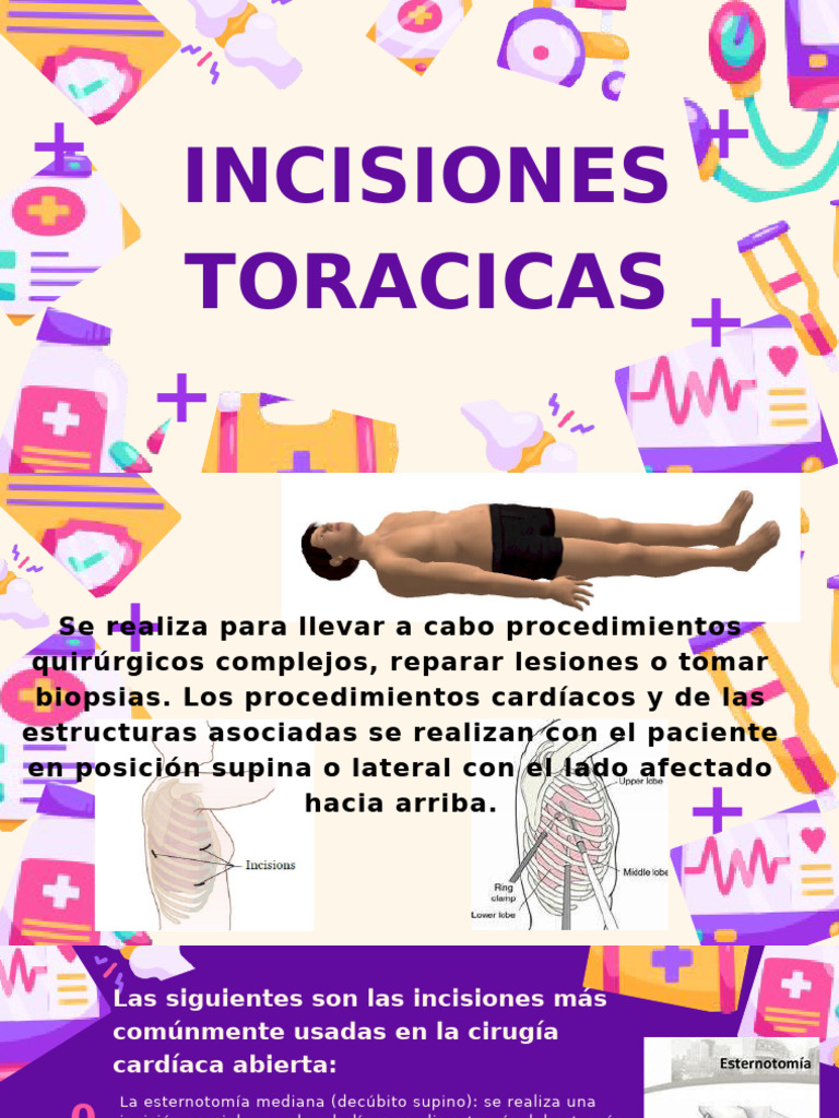Incisiones Toracicas | PDF | Cirugía de bypass de la arteria coronaria ...