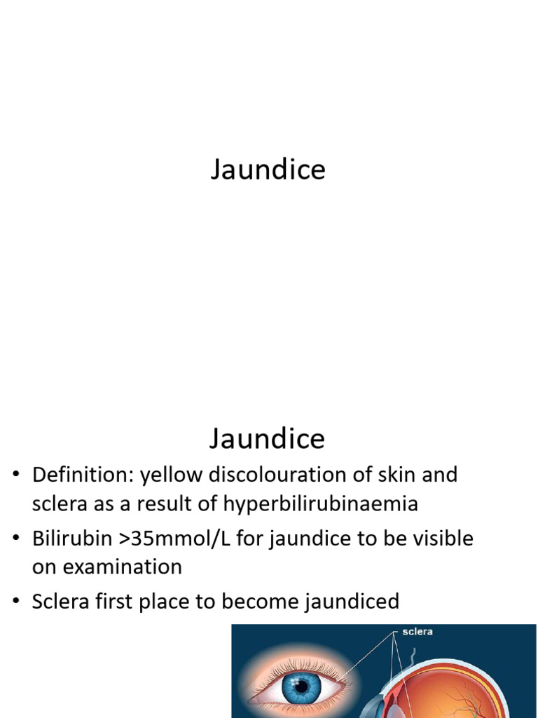 Jaundice | PDF | Clinical Medicine | Exocrine System