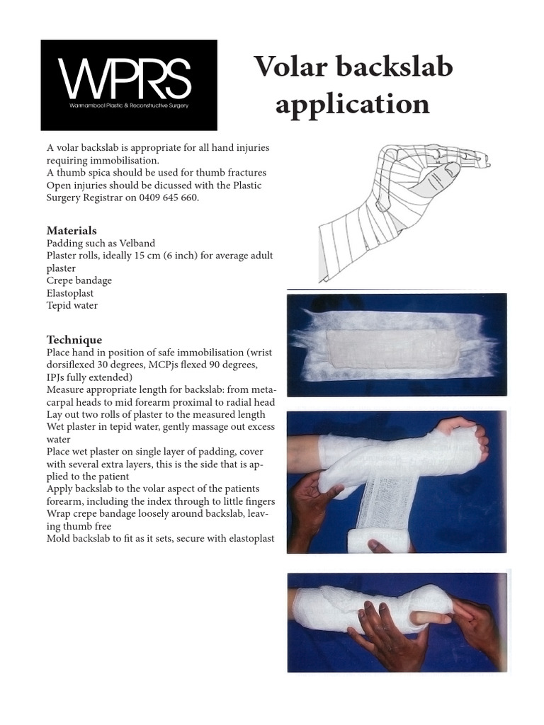Volar Backslab Handout | PDF