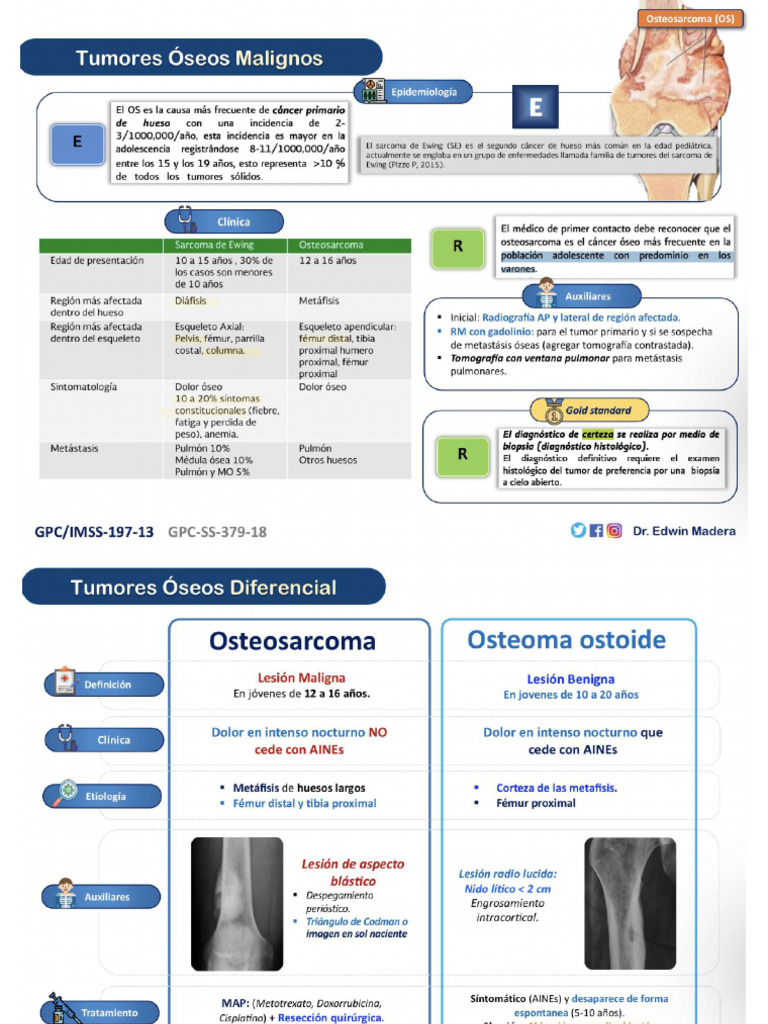 Tumores Óseos Malignos | PDF